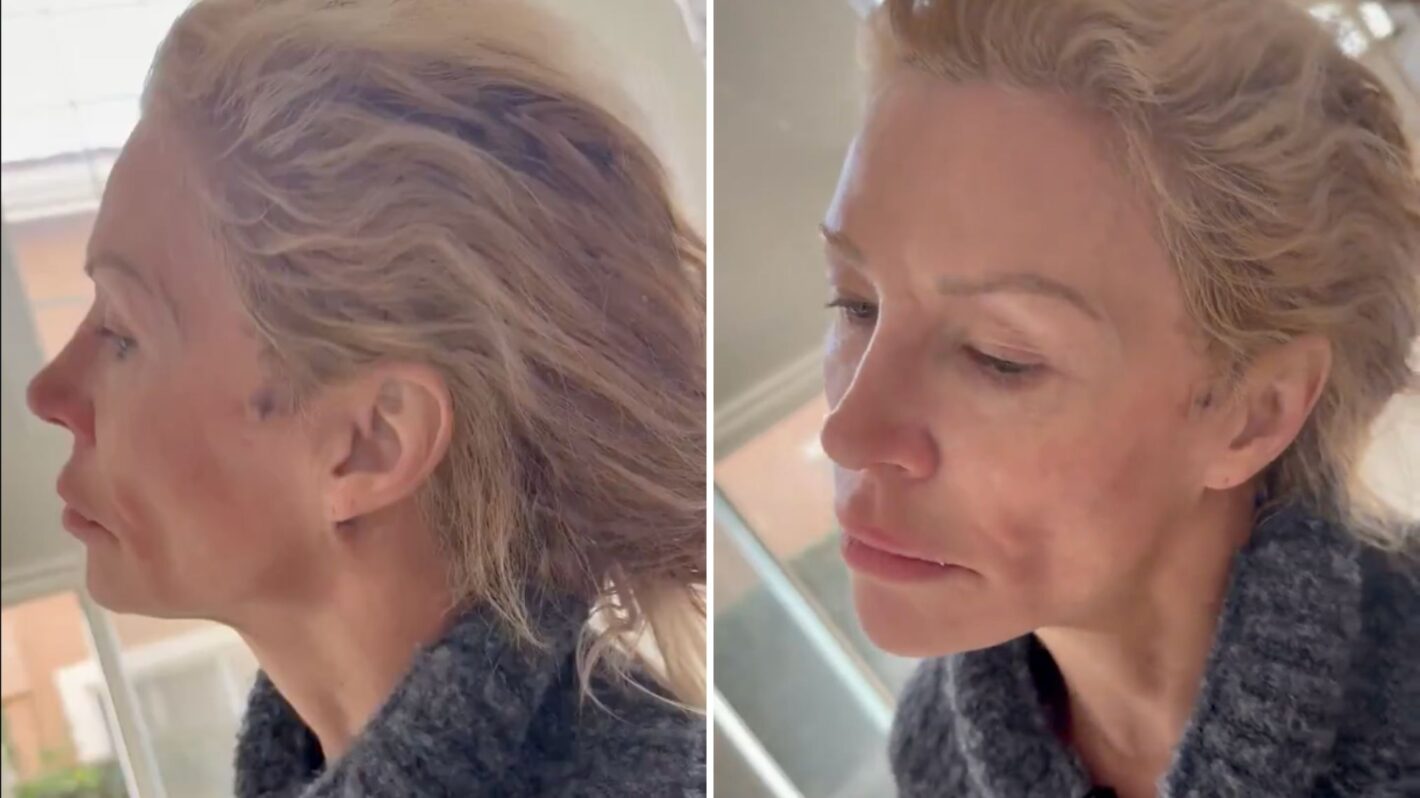 Brandi Glanville Shares ‘Crazy’ Update Amid Treatment for Health Issues